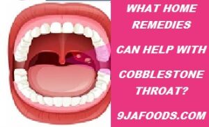 Cobblestone Throat Home Remedies for Throat Bumps - 9jafoods